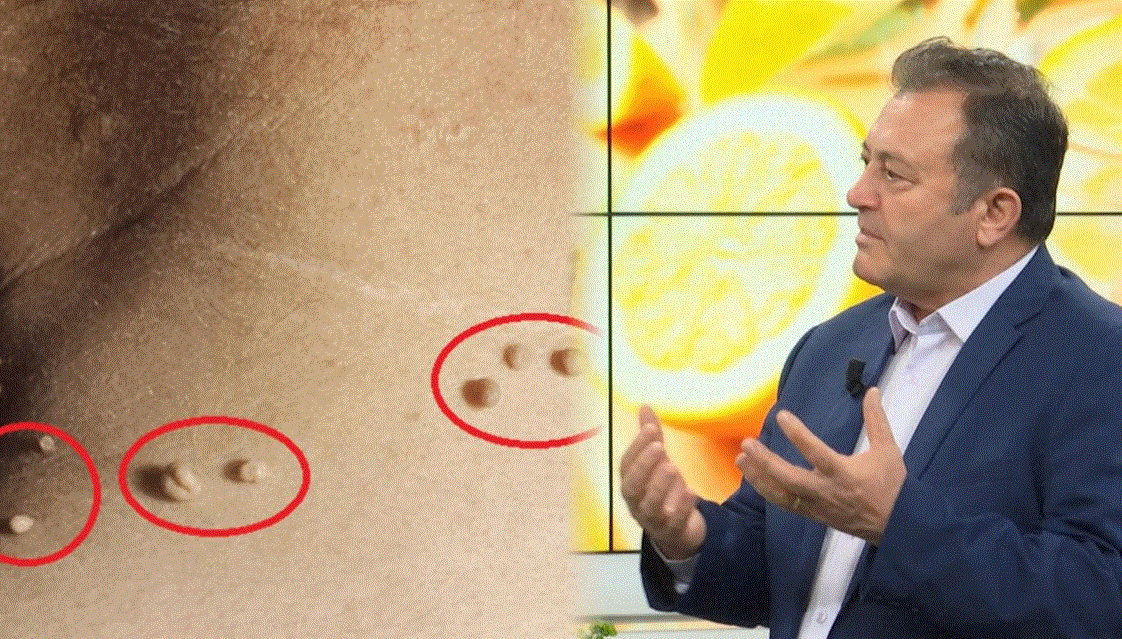 Ylli Merja: Ja bima që zhduk lythat dhe recetat me sodë e bukës për ...